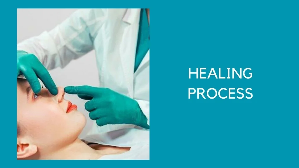 PPT - healing process of RHINOPLASTY SURGERY PowerPoint Presentation ...