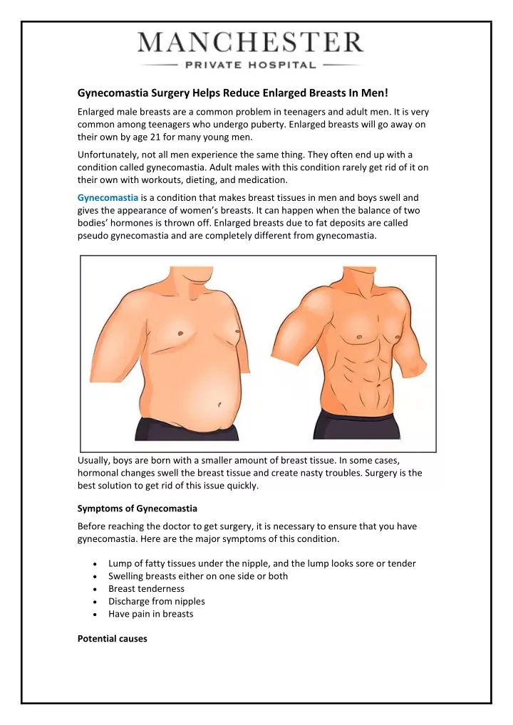 Ppt Gynecomastia Surgery Helps Reduce Enlarged Breasts In Men