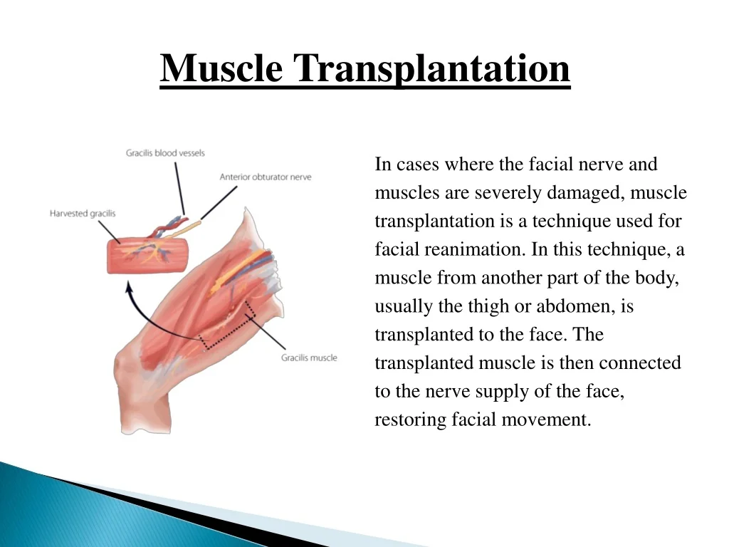 PPT - Leading Clinic For Facial Paralysis Treatment in Mumbai ...
