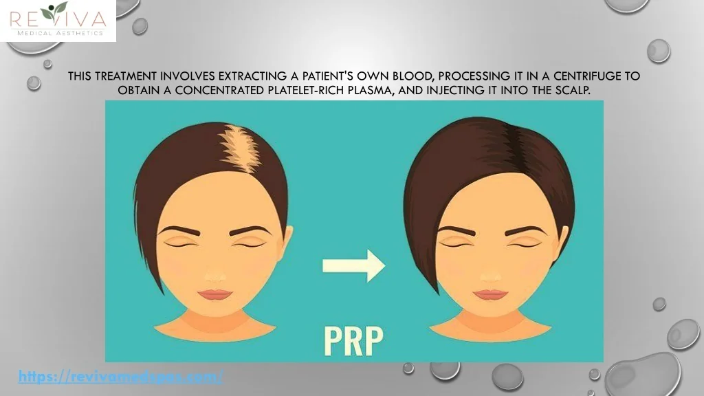 PPT - PRP Hair Treatment PowerPoint Presentation, free download - ID ...