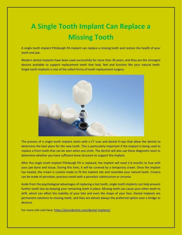PPT - A Single Tooth Implant Can Replace a Missing Tooth PowerPoint ...