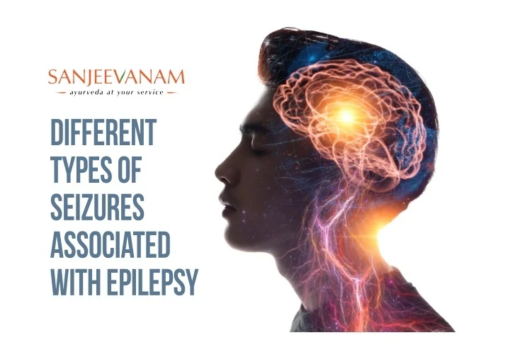 PPT - Different Types of Seizures Associated with Epilepsy PowerPoint ...