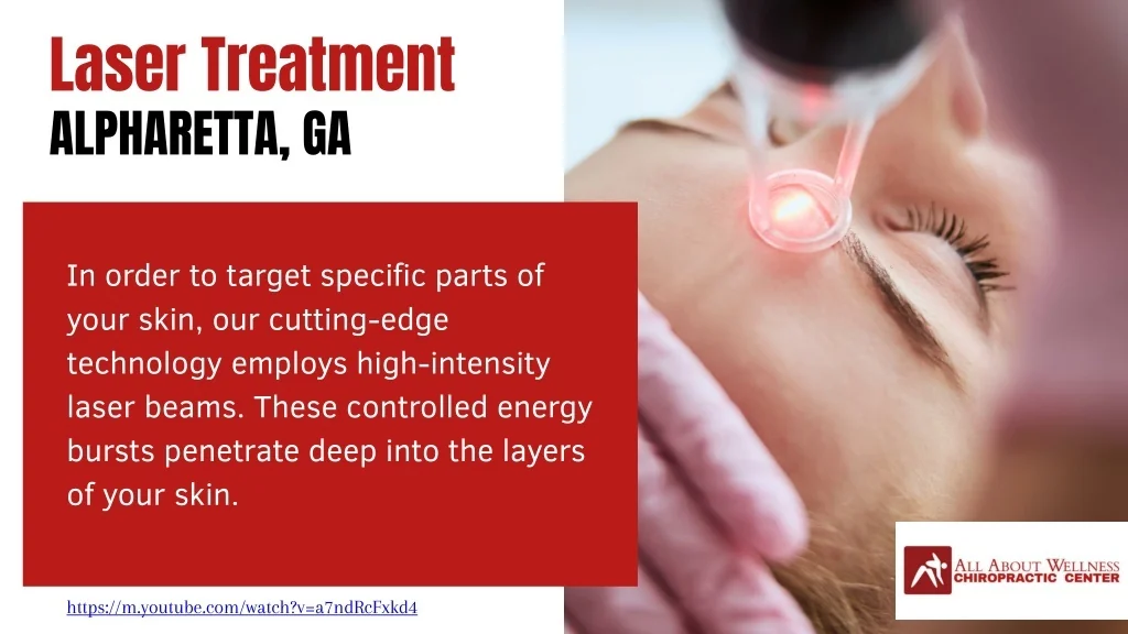 PPT - Laser Treatment Alpharetta, GA PowerPoint Presentation, free ...
