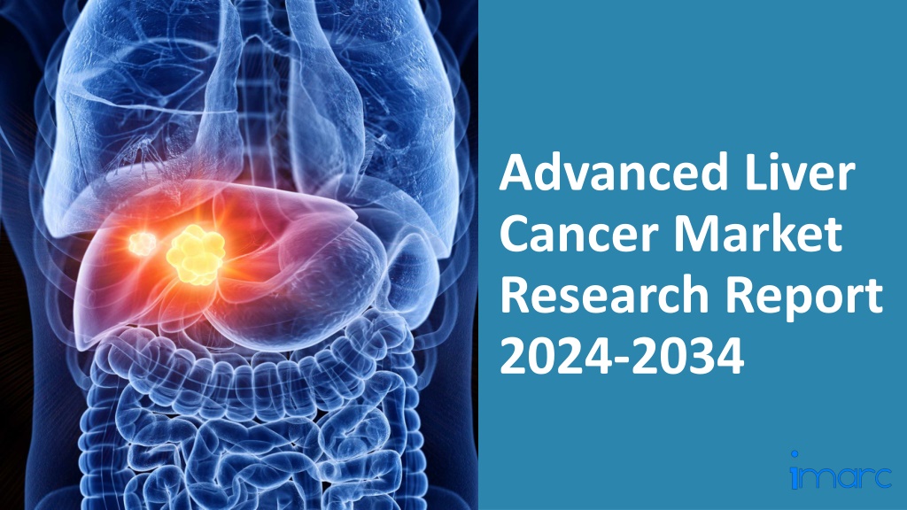 Ppt Advanced Liver Cancer Market 2024 2034 Powerpoint Presentation