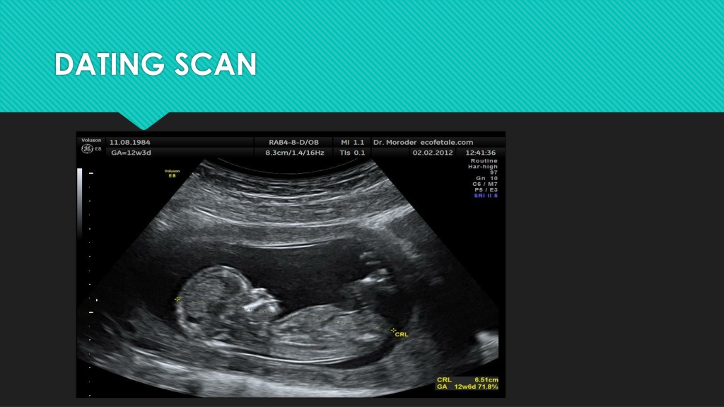 Ppt Transvaginal Ultrasound Powerpoint Presentation Free Download