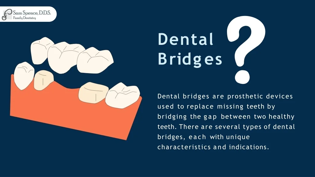 PPT - Dental Bridges And It's Types Explained | Sam Spence D.D.S ...