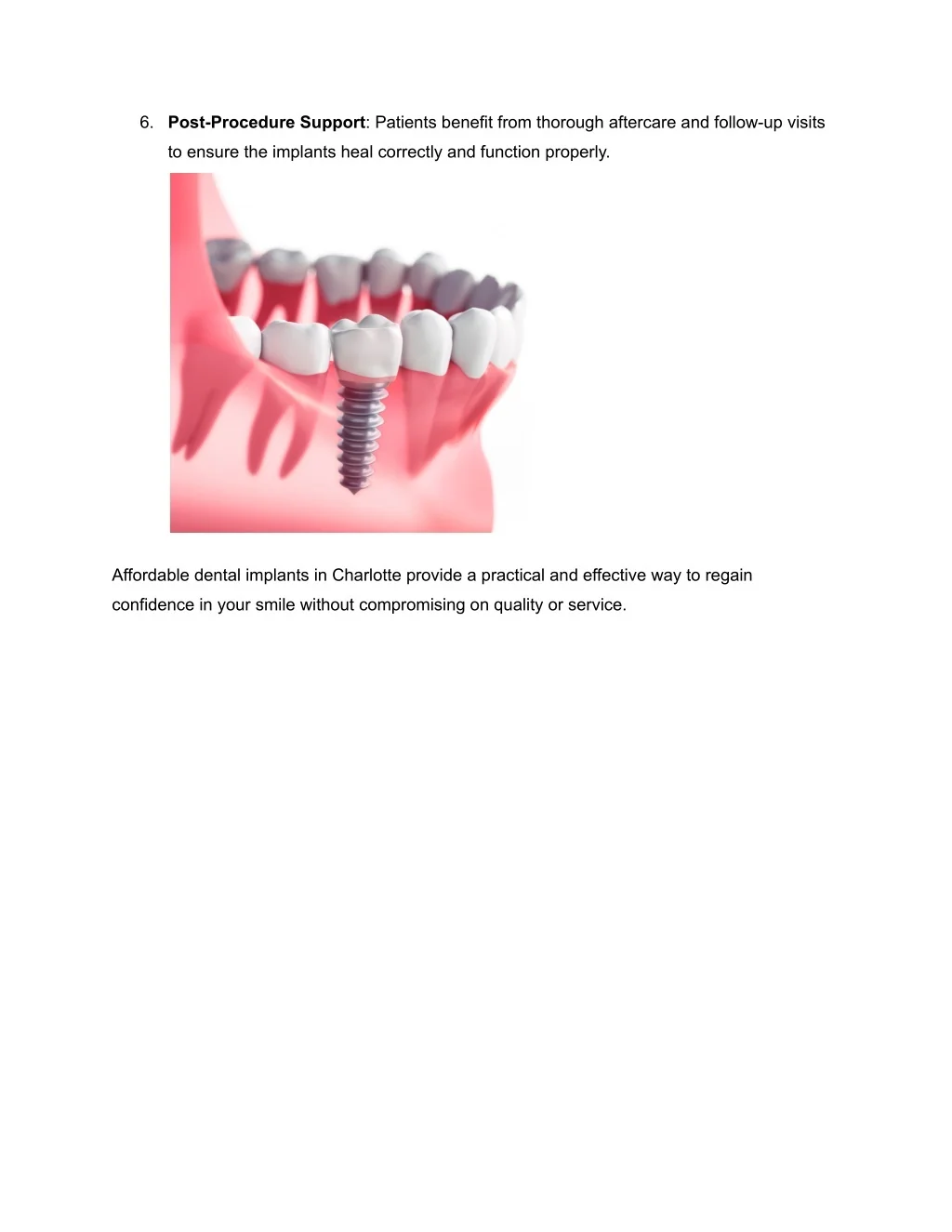 PPT - Affordable dental implants in Charlotte PowerPoint Presentation ...