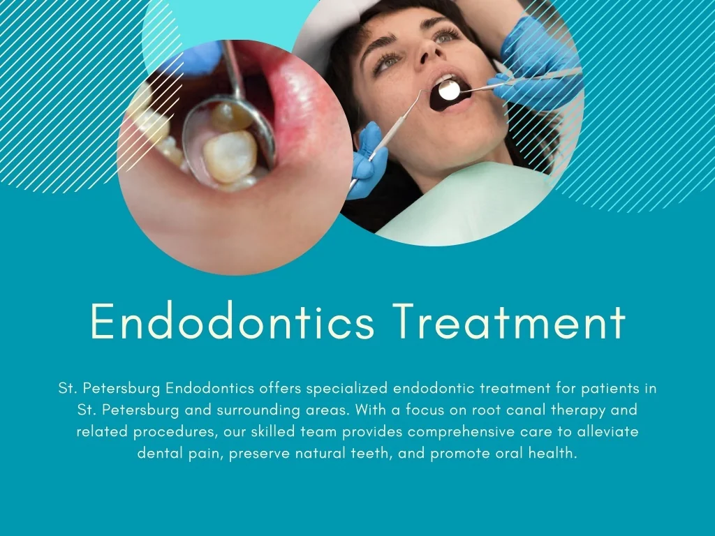 PPT - Root Canal Treatment PowerPoint Presentation, free download - ID ...