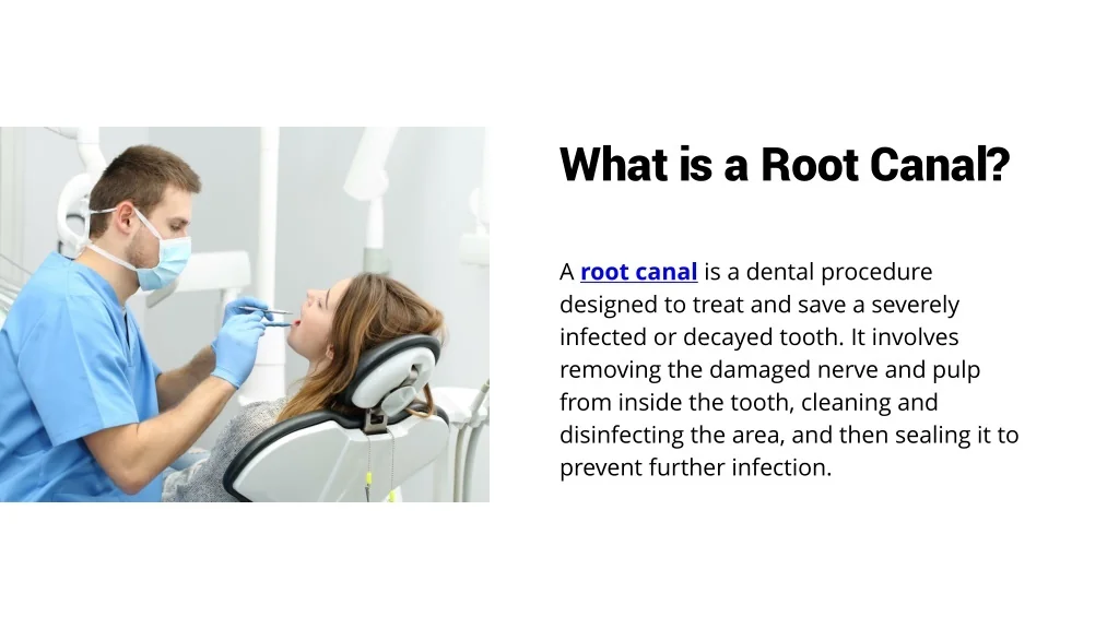 PPT - Root Canal Treatment PowerPoint Presentation, free download - ID ...