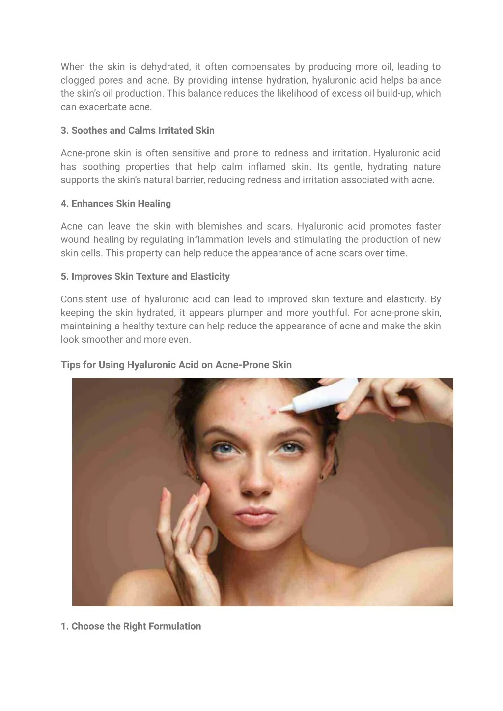 PPT - Hyaluronic Acid for Acne-Prone Skin Benefits and Tips PowerPoint ...