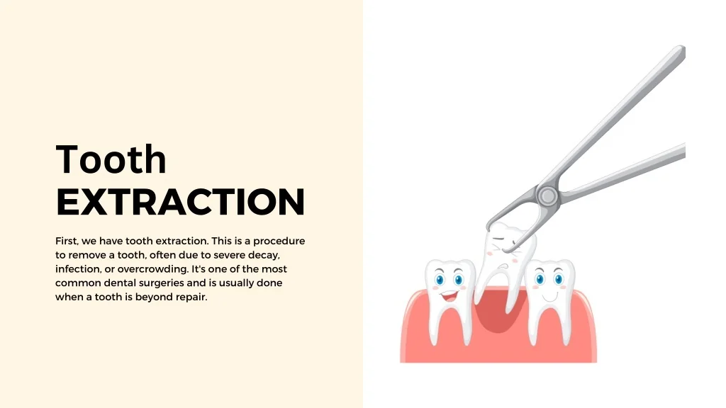 PPT - Most Common Types of Dental Surgery PowerPoint Presentation, free ...