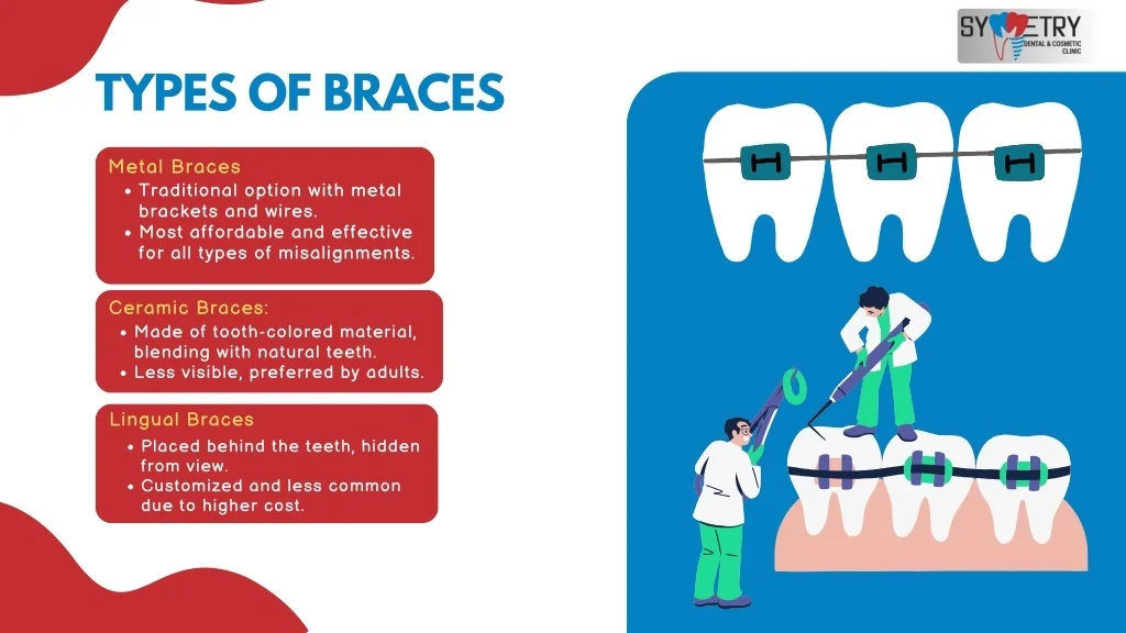 PPT - Best Braces Specialist Near Me in Gurgaon PowerPoint Presentation ...