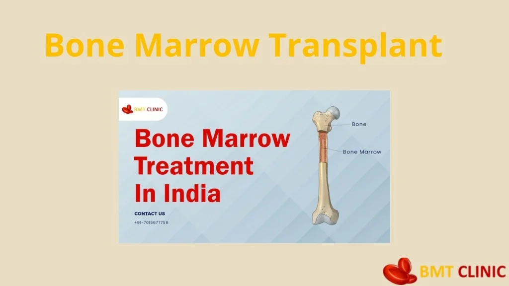 PPT - Comprehensive Guide to Bone Marrow Transplant Costs in India ...