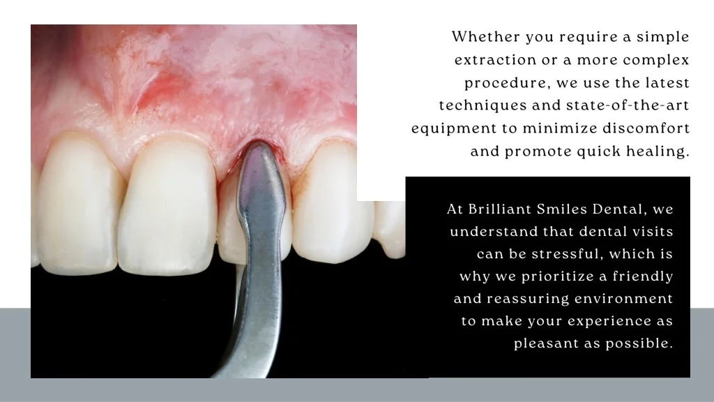 PPT - Tooth Extraction Delray Beach, FL PowerPoint Presentation, free ...