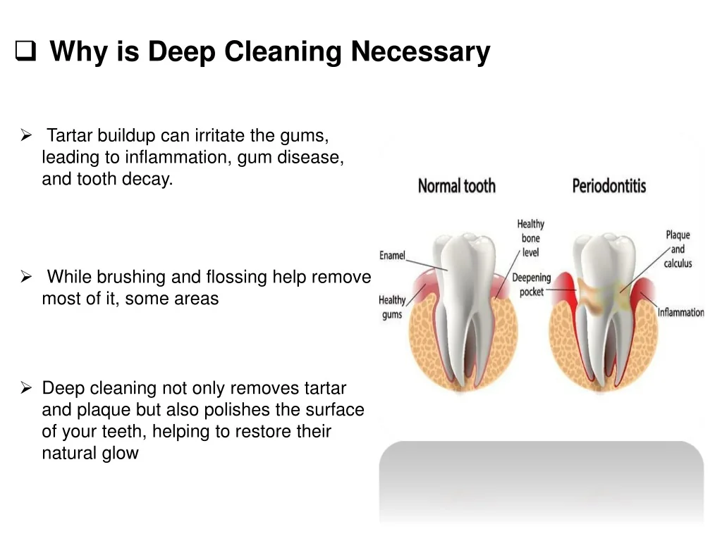 PPT - Natural Glow The Essential Guide to Deep Teeth Cleaning ...