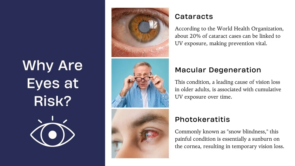 PPT - Protecting Your Eyes from UV Radiation: Essential Tips for Sun ...